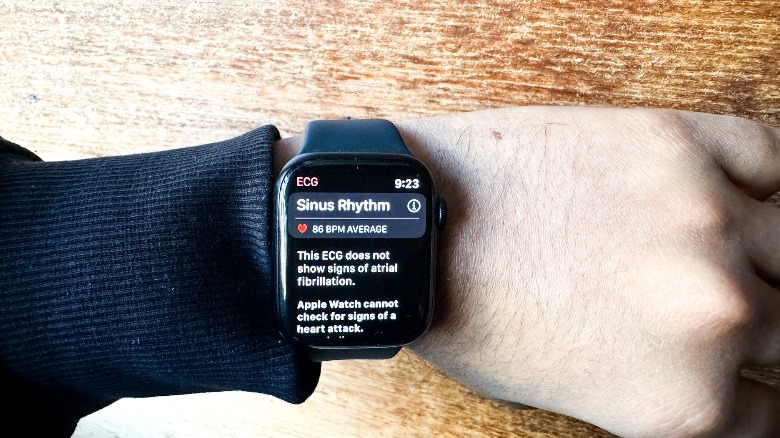 How To Take An ECG With Your Apple Watch
