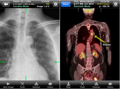 iPad Radiology App For Mobile Diagnosis Approved By FDA