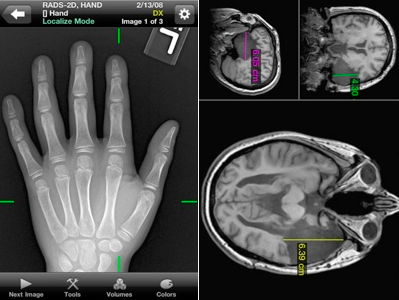 iPad Radiology App For Mobile Diagnosis Approved By FDA