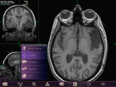 iPad Radiology App For Mobile Diagnosis Approved By FDA