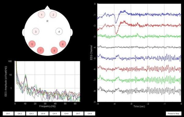 OpenBCI tries to make brain computer interfaces more accessible - SlashGear