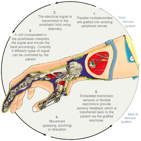 Bionic hand restores amputee's sense of touch - SlashGear