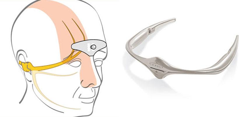 Cefaly headband gets FDA approval for migraine treatment - SlashGear