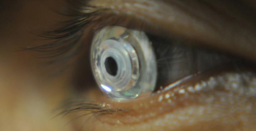 Zooming contact lenses enlarge at a wink - SlashGear