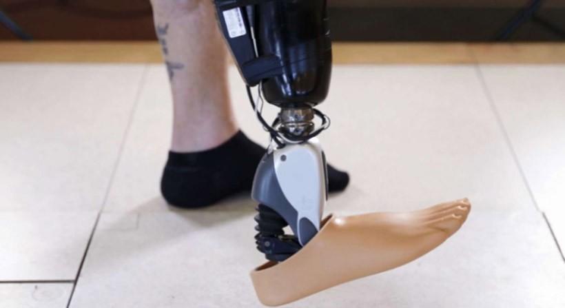 Mind-controlled bionic prosthetic legs unveiled by Ossur - SlashGear