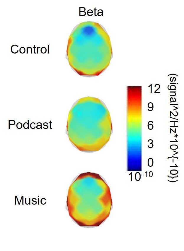 Portable Eeg Machine Shows How Music Affects The Brain During Exercise