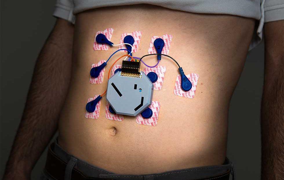 Wearable device monitors electrical activity in the stomach - SlashGear