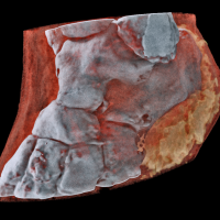 Behold, 3D color X-rays: MARS scanner, made with CERN tech - SlashGear