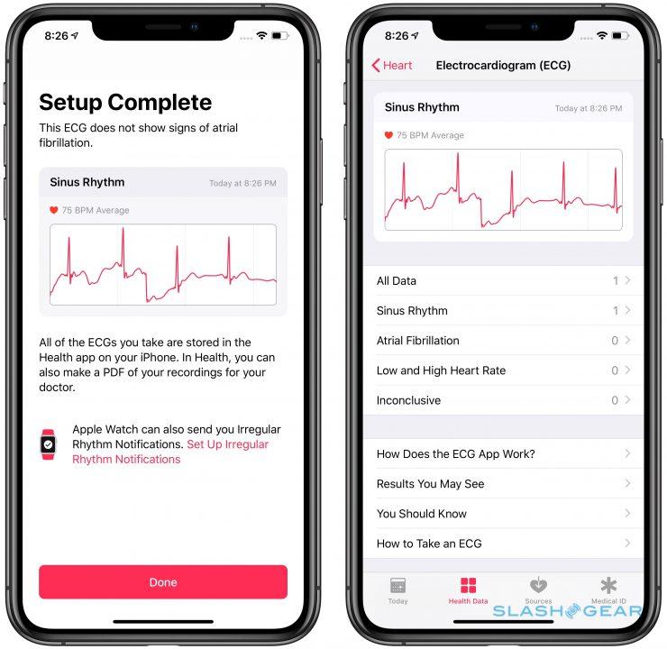 The Apple Watch ECG app is my heart's new best friend - SlashGear