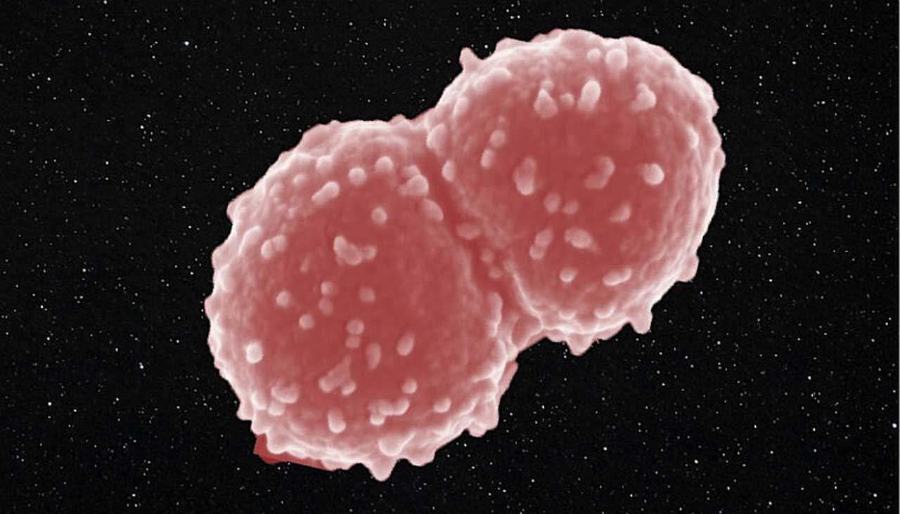 Deinococcus radiodurans survived an entire year outside the ISS - SlashGear