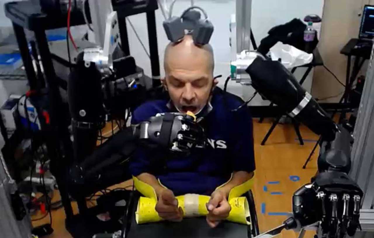 Quadriplegic feeds himself using brain signals and advanced prosthetics ...