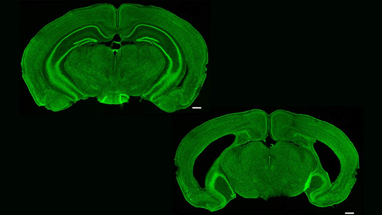 Researchers study the mouse brain to learn about the memory center ...